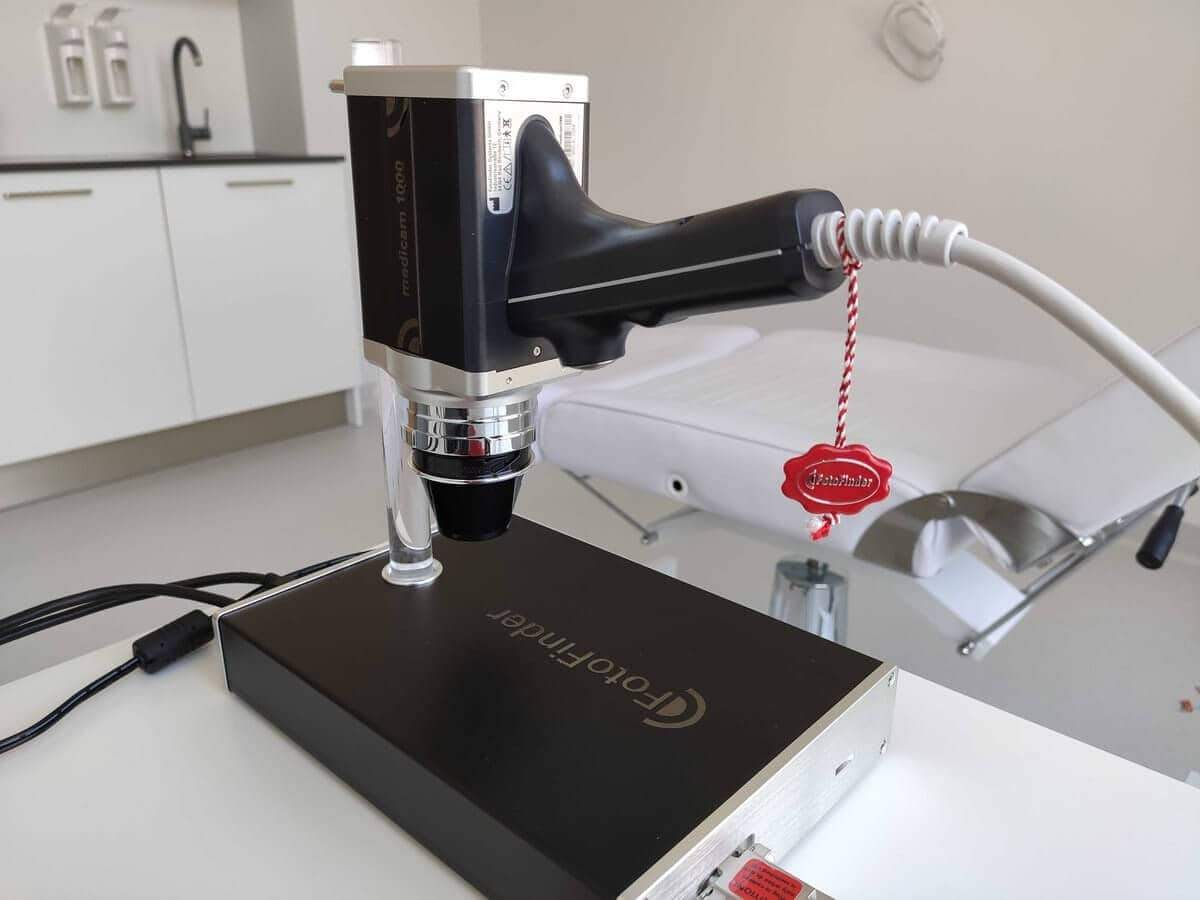 Wideodermatoskopia - komputerowe badanie znamion