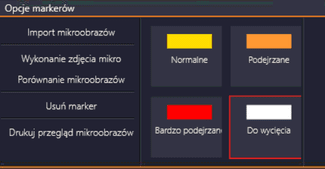 Wideodermatoskopia - komputerowe badanie znamion