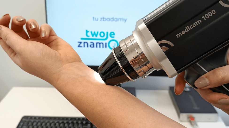 Jak powinno wyglądać badanie dermatoskopowe?