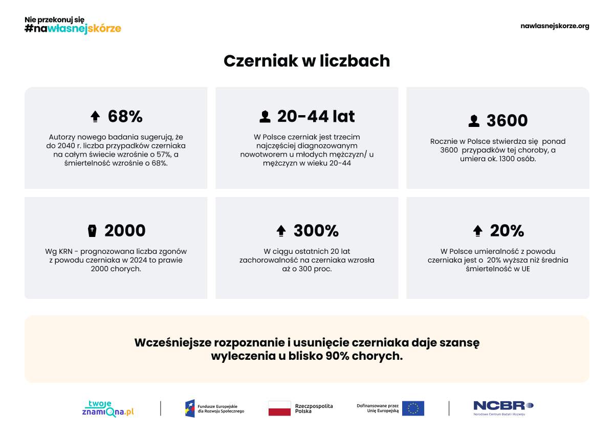 Czerniak - jak rozpoznać? Infografiki