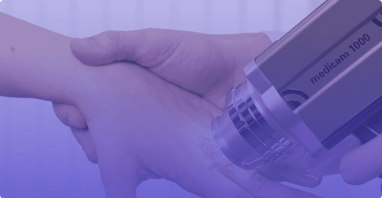 Wideodermatoskopia - komputerowe badanie znamion